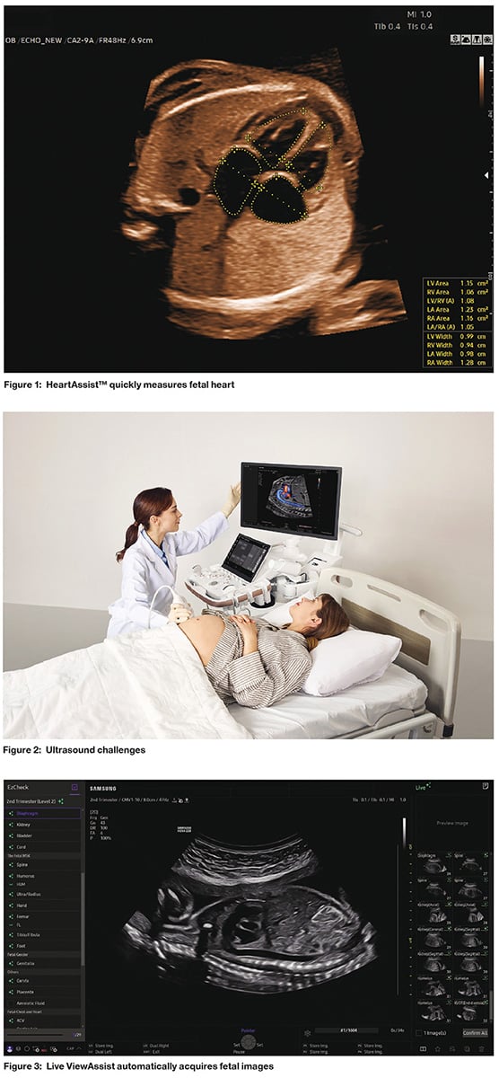Samsung Healthcare USA | Ultrasound | Women's Health | AI | Dr Chavez