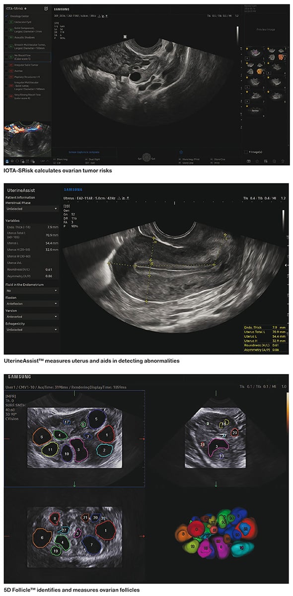 Samsung Healthcare USA | Ultrasound | Women's Health | AI | Dr Timor