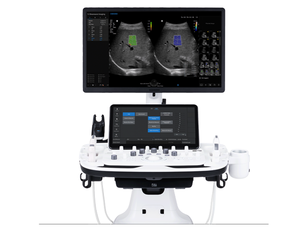 Samsung V7 General Imaging Ultrasound | Samsung Healthcare