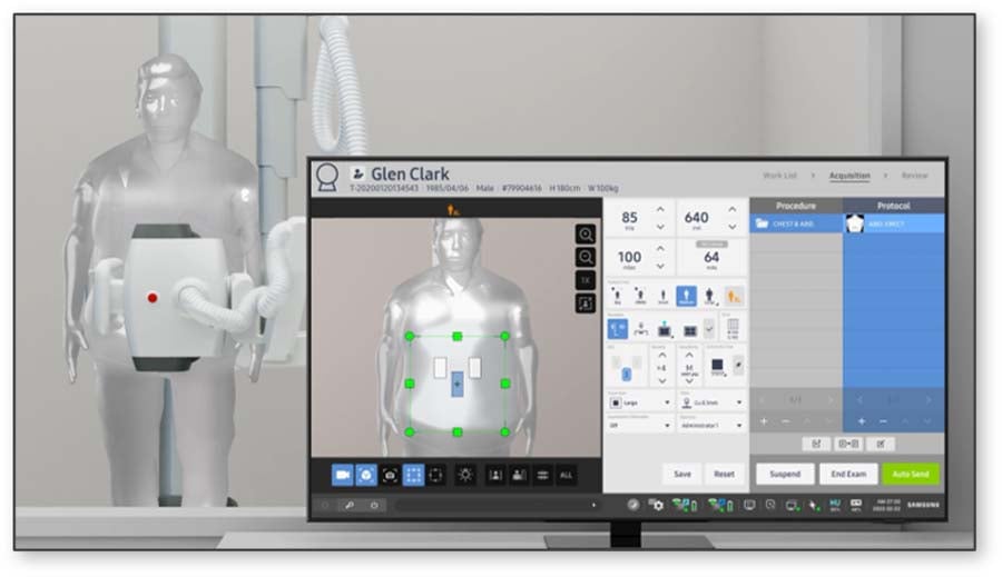 GC85A Vision Radiography Room | Samsung Healthcare