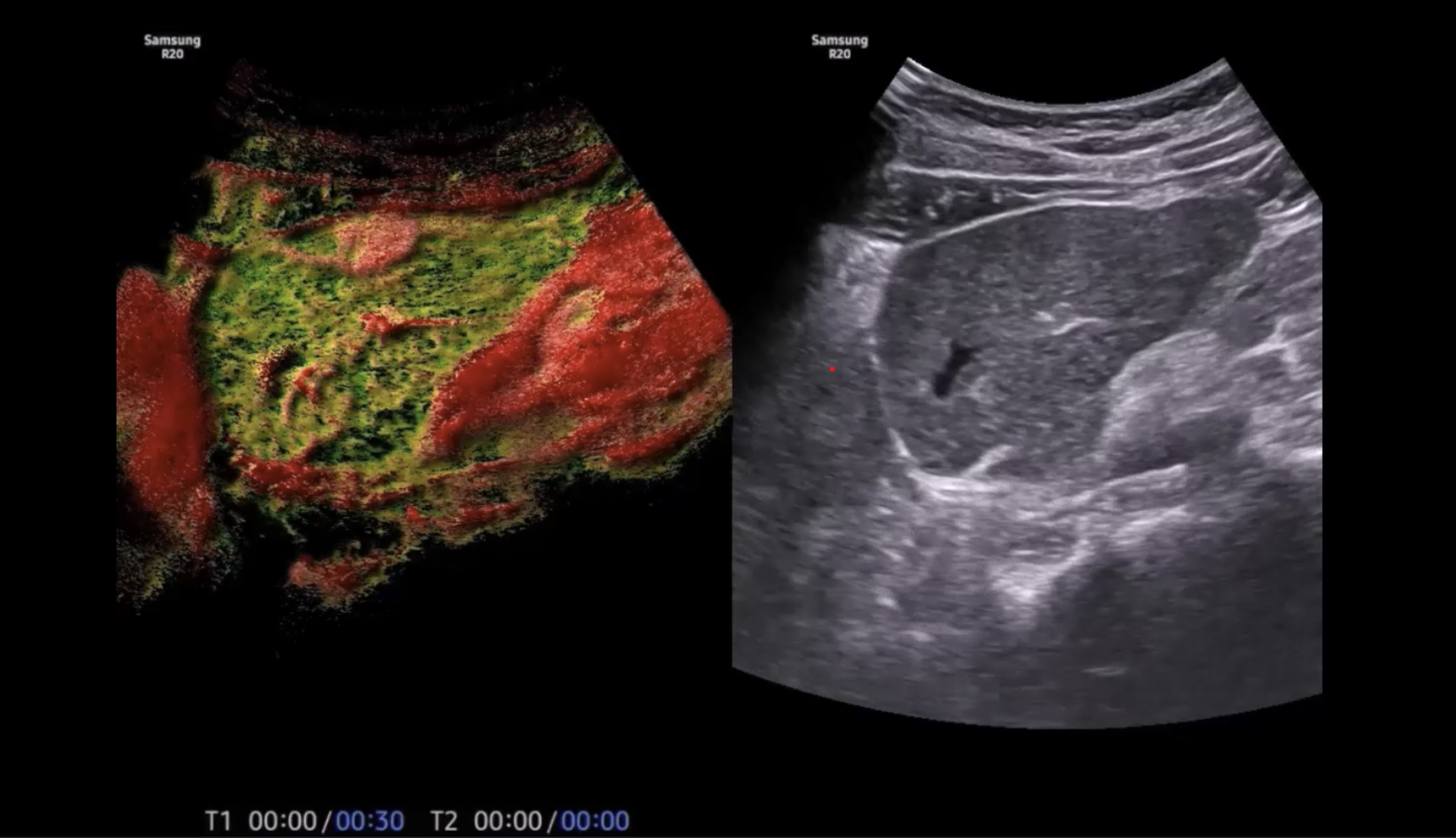 Ultrasound | General Imaging | R20 | Samsung Healthcare