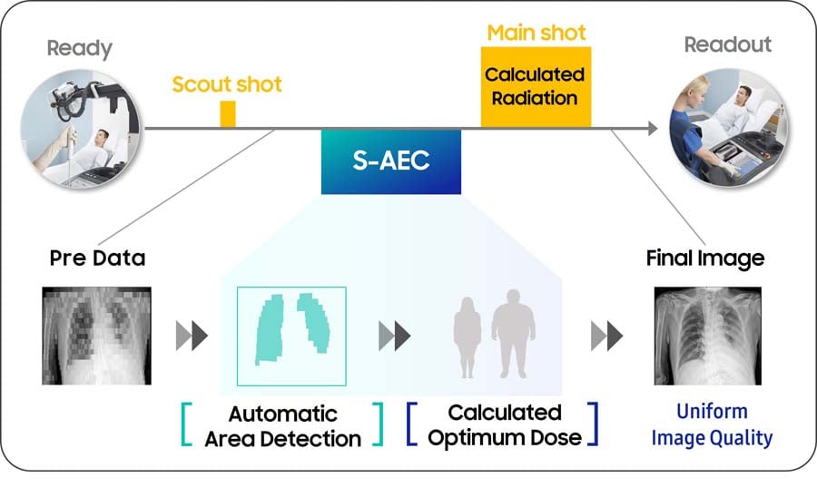 GM85 Elite Mobile Radiography | Samsung Healthcare