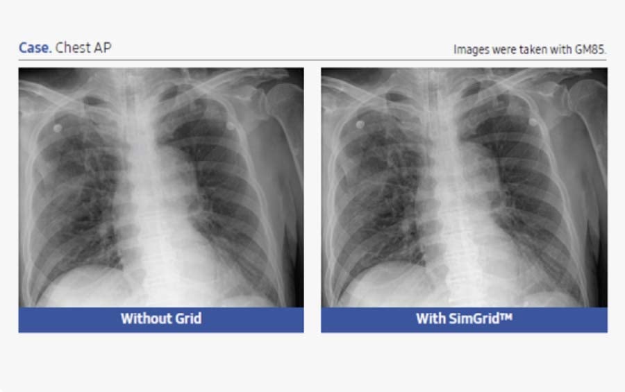 GF85 Radiography Room System | Samsung Healthcare