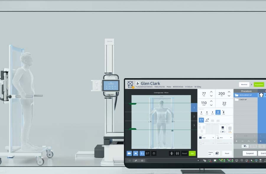 GF85 Radiography Room System | Samsung Healthcare