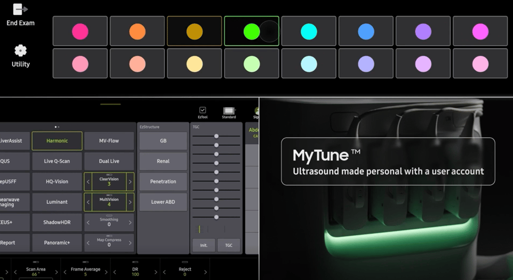 Ultrasound | General Imaging | R20 | Samsung Healthcare