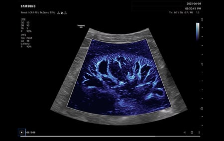Ultrasound | General Imaging | R20 | Samsung Healthcare