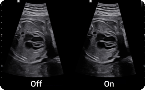 Samsung V7 General Imaging Ultrasound | Samsung Healthcare