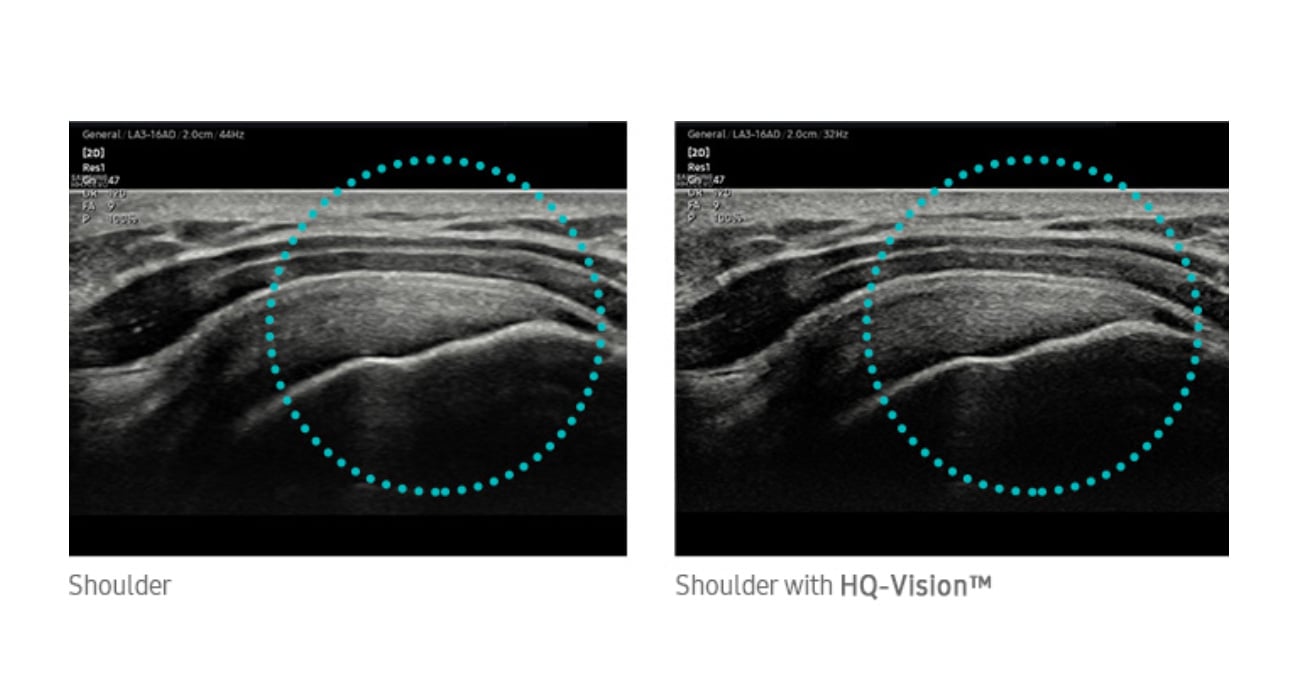 HM70 General Imaging Ultrasound | Samsung Healthcare