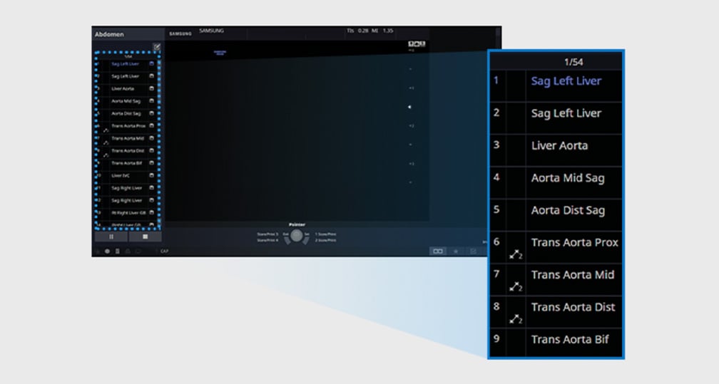 Samsung V7 Point-of-Care Ultrasound | Samsung Healthcare