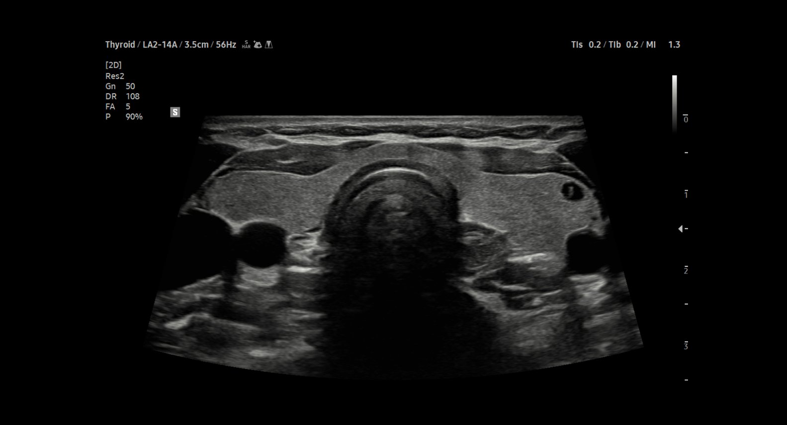 Samsung V7 General Imaging Ultrasound | Samsung Healthcare