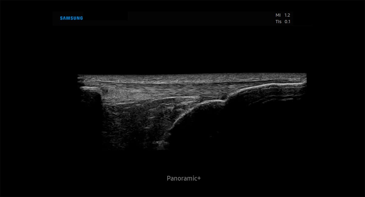 Small Animal Veterinary Ultrasound | Samsung Healthcare