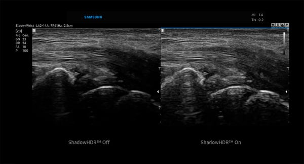 RS85 Prestige POC Ultrasound | Samsung Healthcare USA