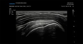 Samsung V7 Point-of-Care Ultrasound | Samsung Healthcare