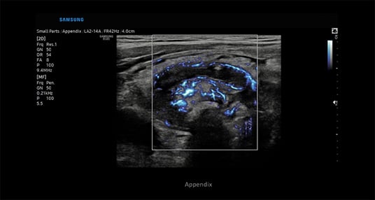 Samsung V7 Point-of-Care Ultrasound | Samsung Healthcare