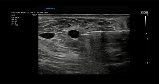 Small Animal Veterinary Ultrasound | Samsung Healthcare