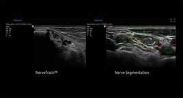 Samsung V7 Point-of-Care Ultrasound | Samsung Healthcare