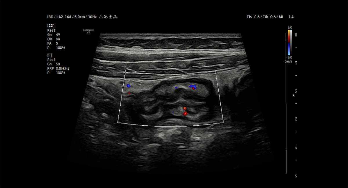 RS85 Prestige POC Ultrasound | Samsung Healthcare USA