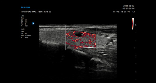 Samsung V5 Point-of-Care Ultrasound | Samsung Healthcare