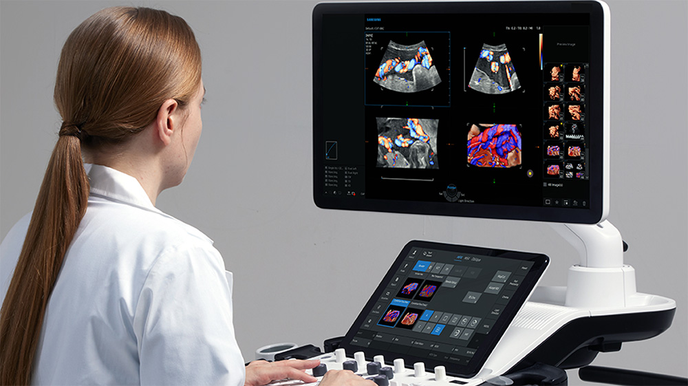 V6 Women’s Health Ultrasound | Samsung Healthcare